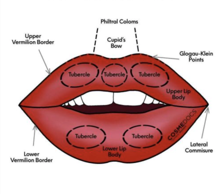 Thin Lips / Shapeless Lips - Skinspire Laser&Skin Clinic