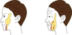 Perioral Mounds - Skinspire Laser&Skin Clinic